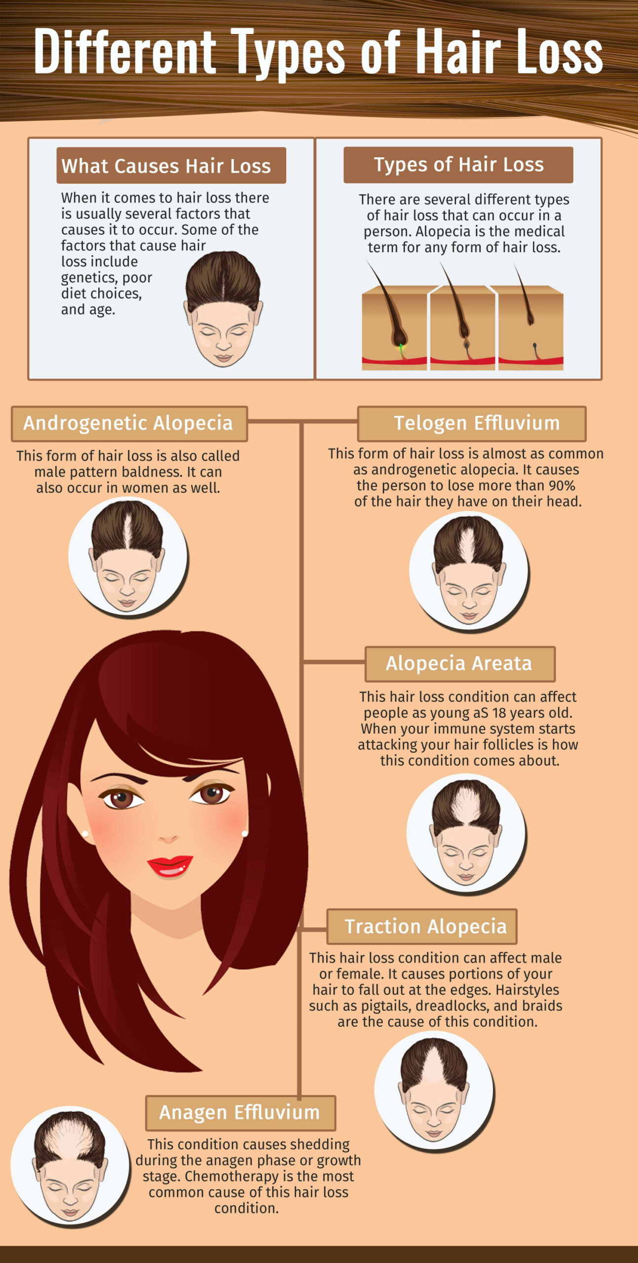 Hair Loss - Urban Skin and Hair Clinic