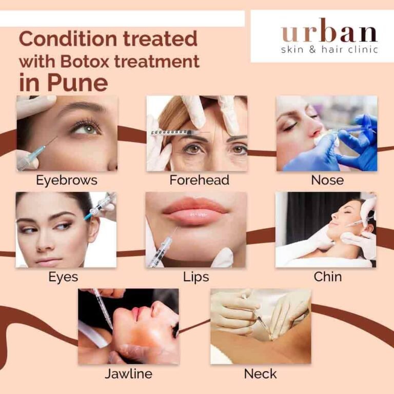 Best clinic for Botox treatment in Pune | Visit now | USHC