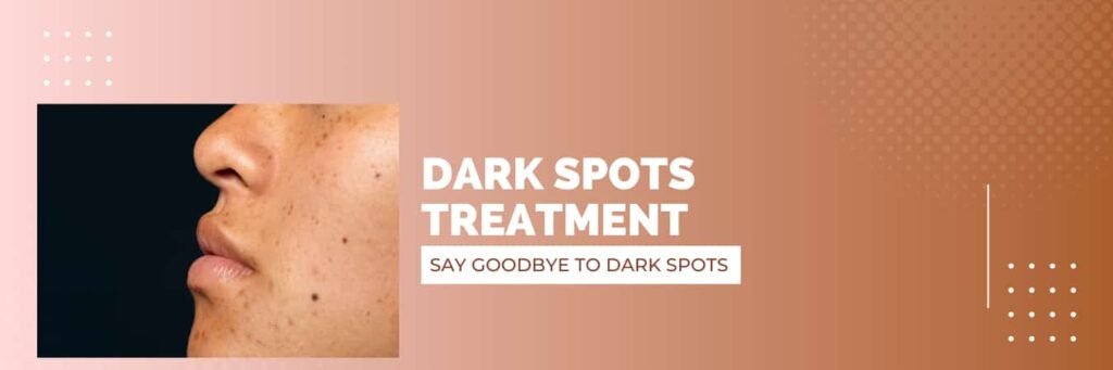 Dark Spot Treatment - Urban Skin and Hair Clinic