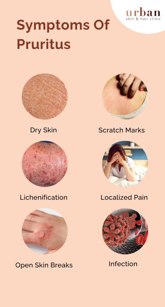 Pruritus Types Causes Symptoms Treatment USHC Pruritus Types Causes Symptoms Treatment USHC