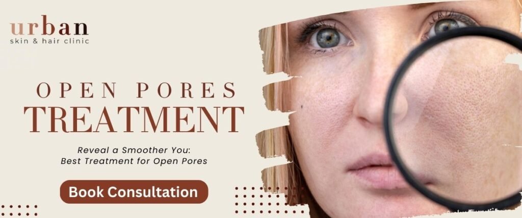 Open Pores Types, Causes, Symptoms & Treatment