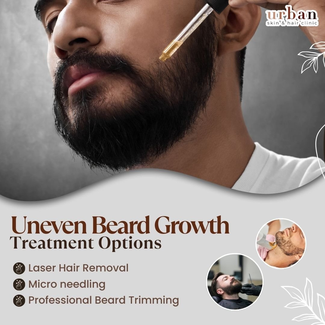 Beard Shaping Treatment in Pune | Urban Skin and Hair Clinic