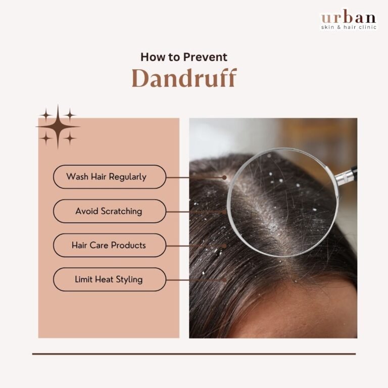 Visit Best Clinic for Dandruff Treatment | USHC