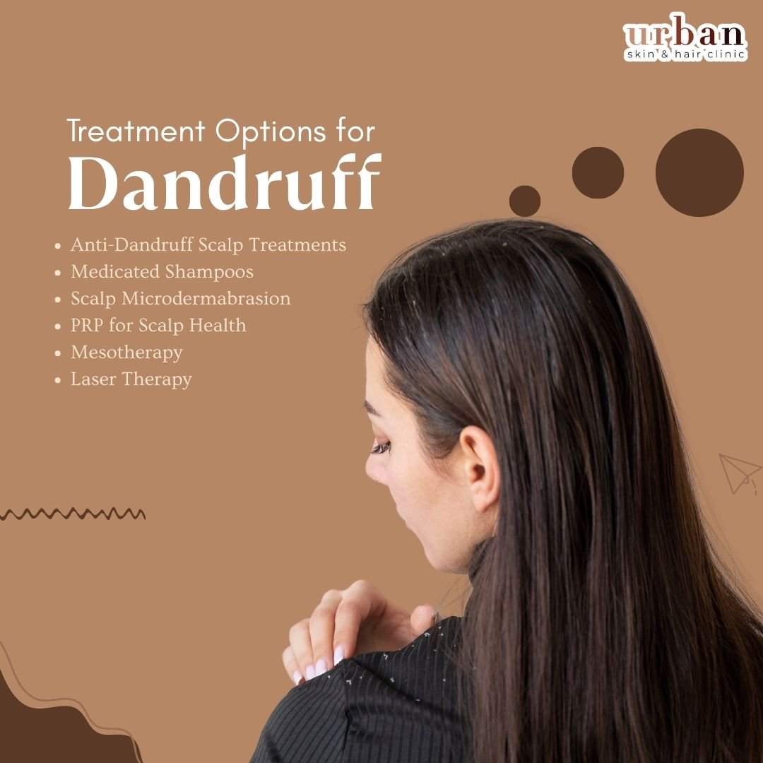 Dandruff treatment - Urban Skin and Hair Clinic