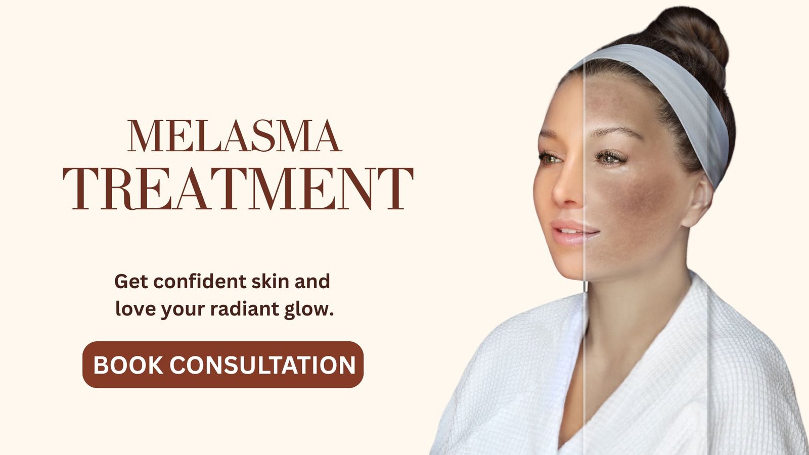 Melasma treatment - Urban Skin and Hair Clinic