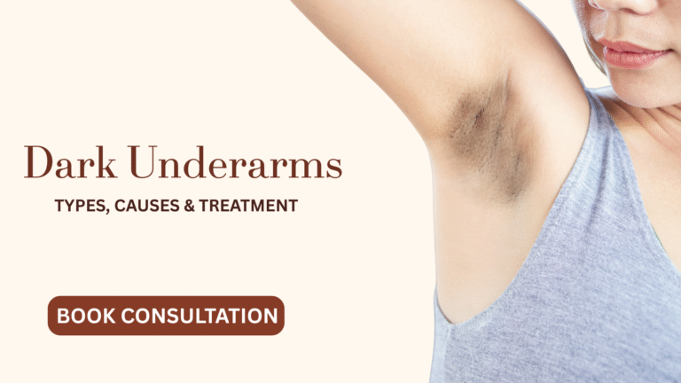 Dark Underarms Causes, Type, Symptoms & Treatment | USHC
