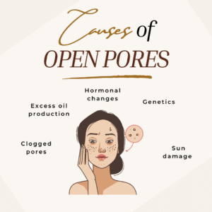 Open Pores Types, Causes, Symptoms & Treatment