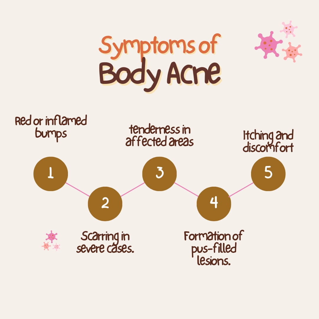 Body Acne Type, Causes, Symptoms & Treatment