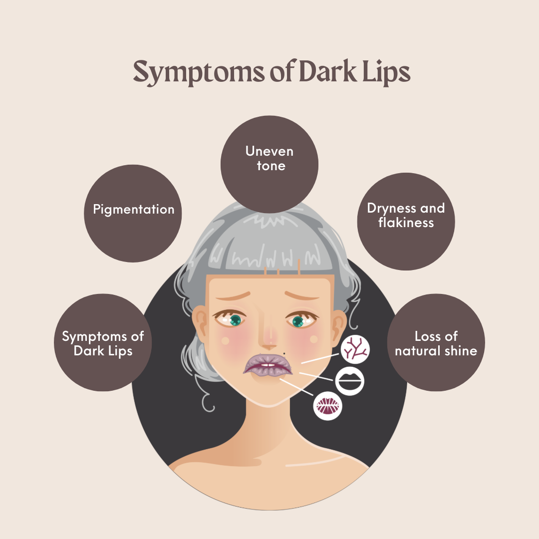 Dark Lips Types, Causes, Symptoms & Treatment