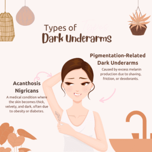 Dark Underarms Causes, Type, Symptoms & Treatment | USHC