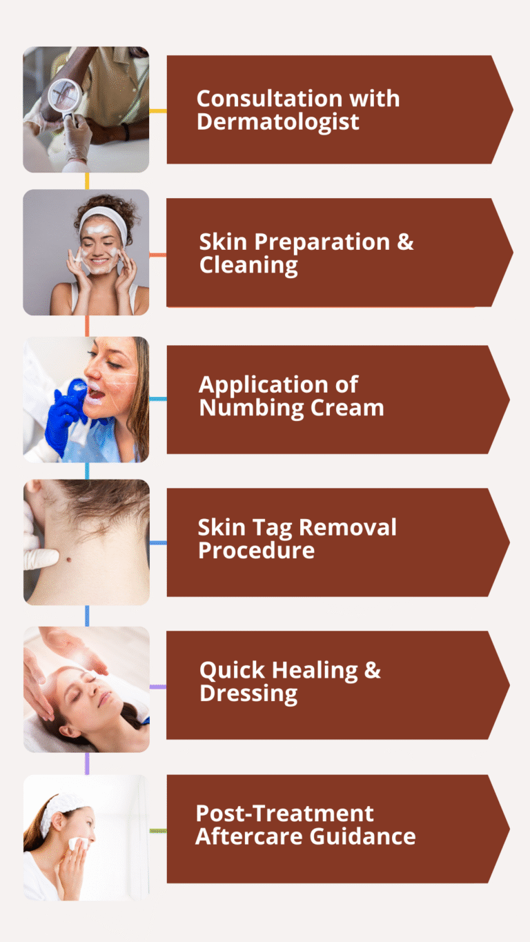 Best Skin Tag Removal Treatment in India - USHC