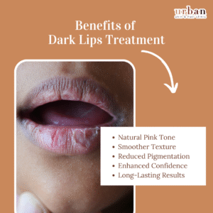 Dark Lips Types, Causes, Symptoms & Treatment