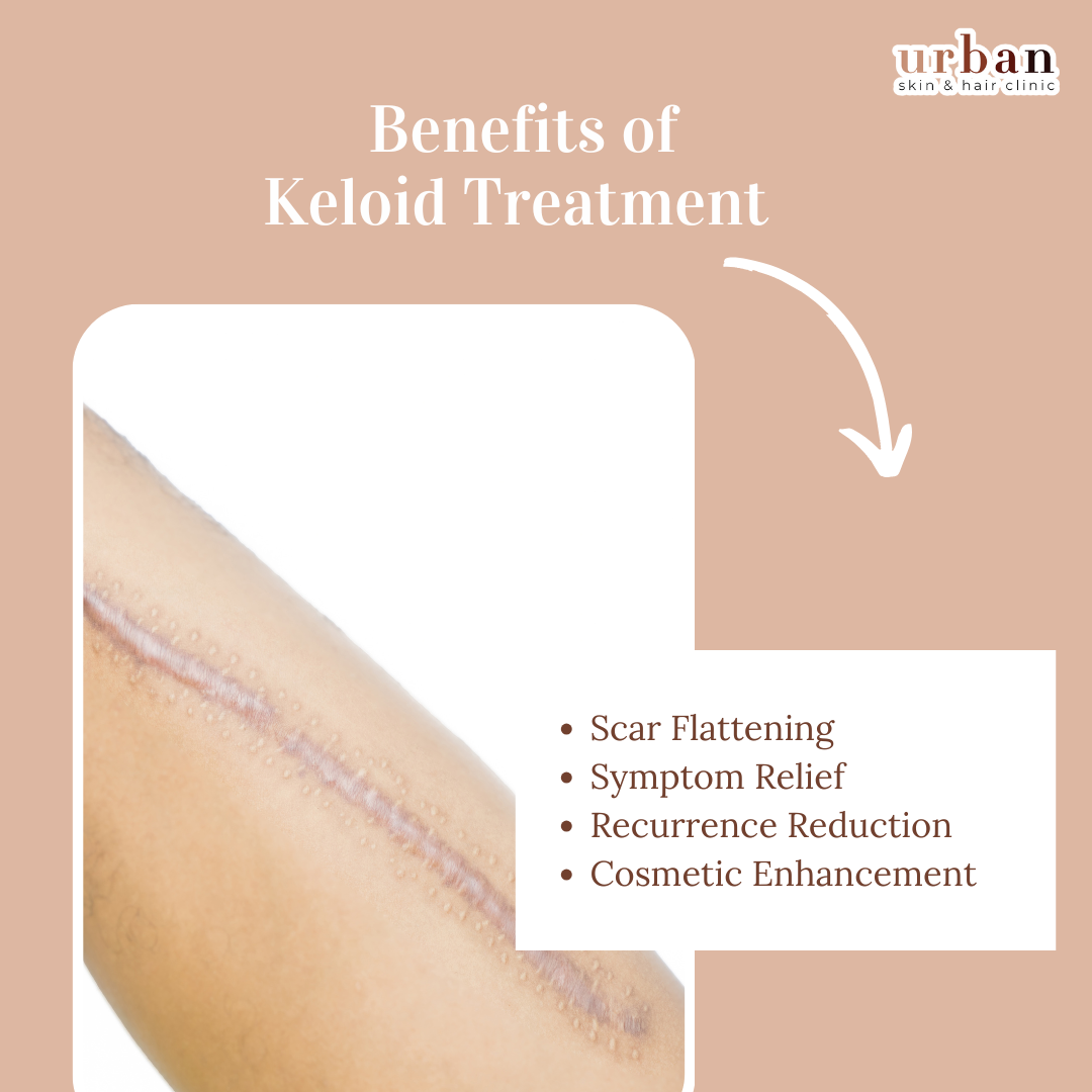 Keloid Types, Causes, Symptoms & Treatment | USHC